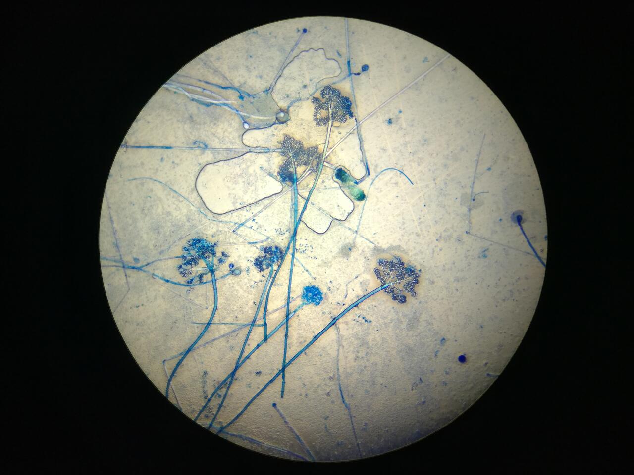 Agdia Commercializes Rapid Molecular Test Kit for Gray Mold Pathogen ...
